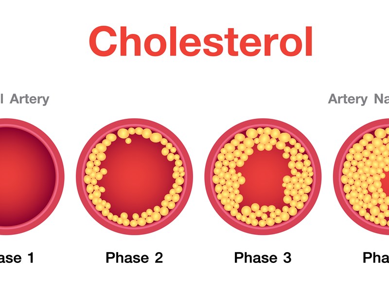Blood cholesterol | Know Diabetes Blood cholesterol | Know Diabetes